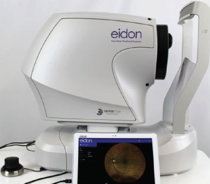 Is It Time to Rethink the Slit Lamp? - Glaucoma Today