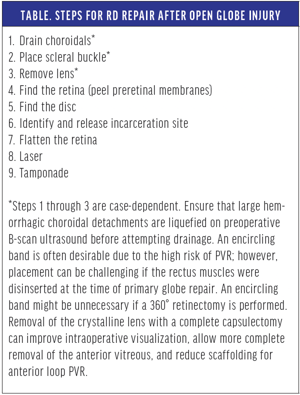 How To Handle Traumatic Retinal Detachments - Retina Today