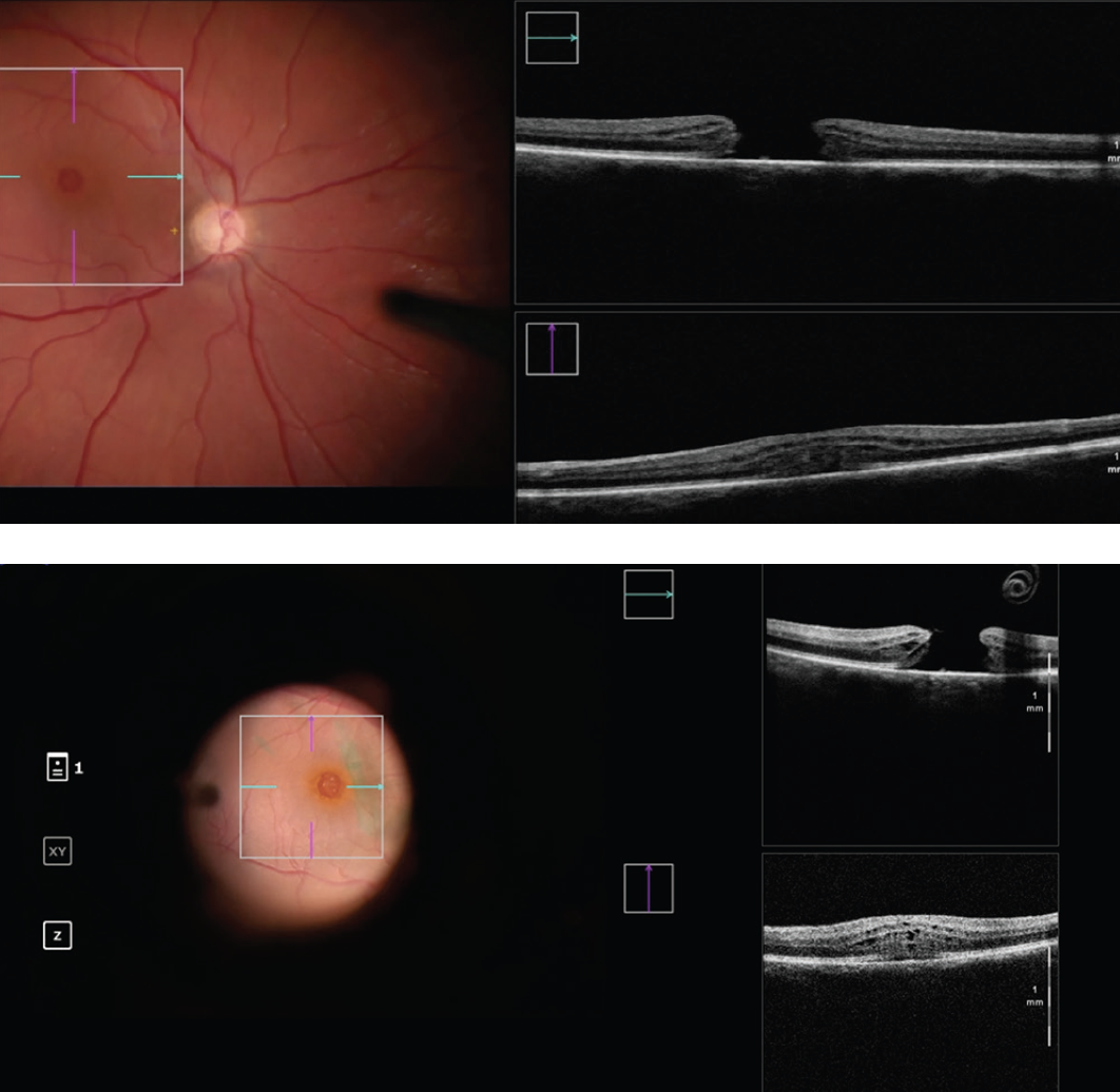 The Pros and Cons of 3D Visualization - Retina Today
