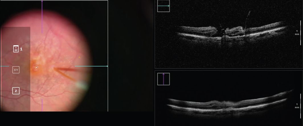 The Pros and Cons of 3D Visualization - Retina Today