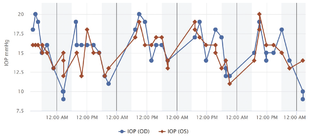 To Treat or Not to Treat - Glaucoma Today