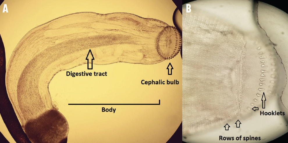 A ‘Serous’ Floater - Retina Today