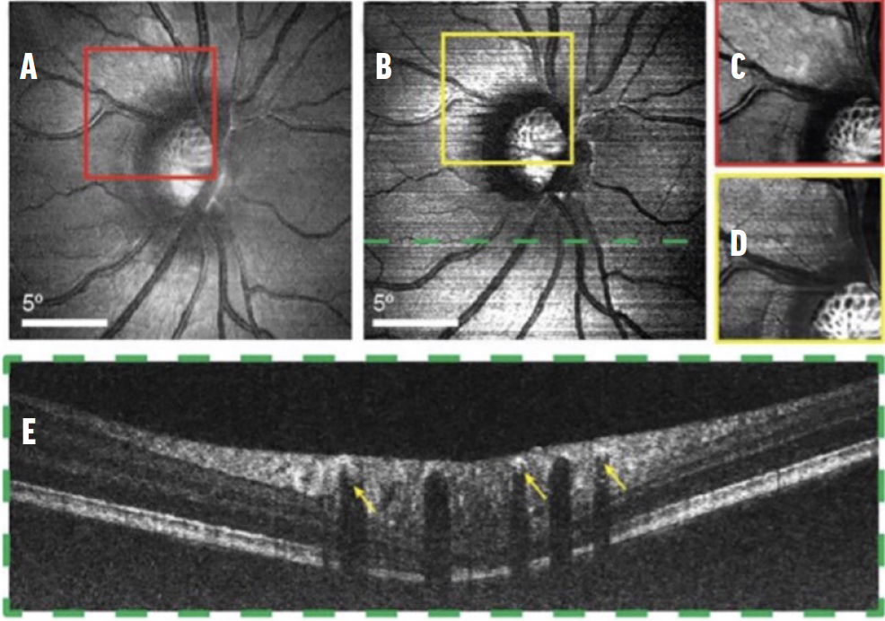 Retinal Imaging Pipeline Updates - Retina Today