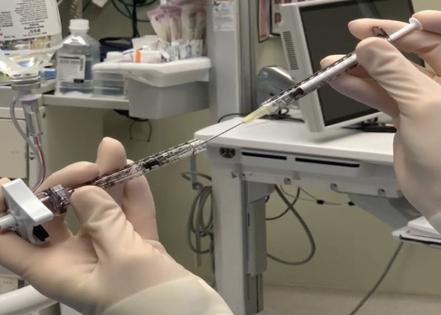 10 Tips for Subretinal Delivery - Retina Today