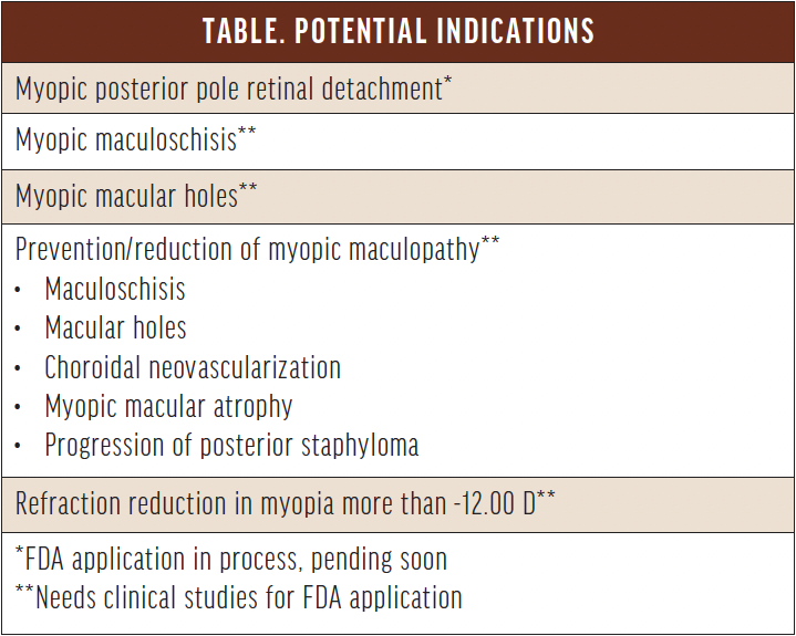 Macular Buckling for Myopia: A Novel Approach - Retina Today