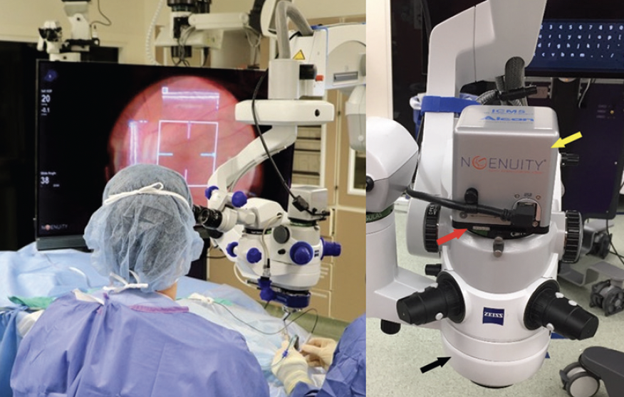 3D Heads-Up Display: Pearls for New Users - Retina Today