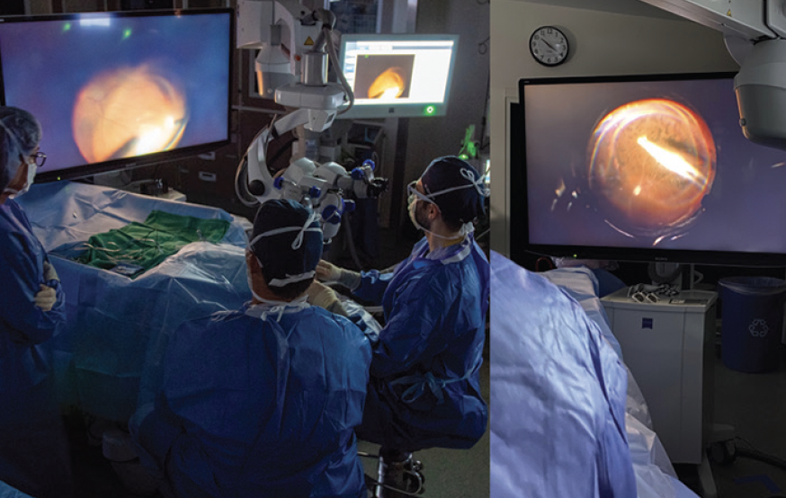 3D Heads-Up Display: Pearls for New Users - Retina Today