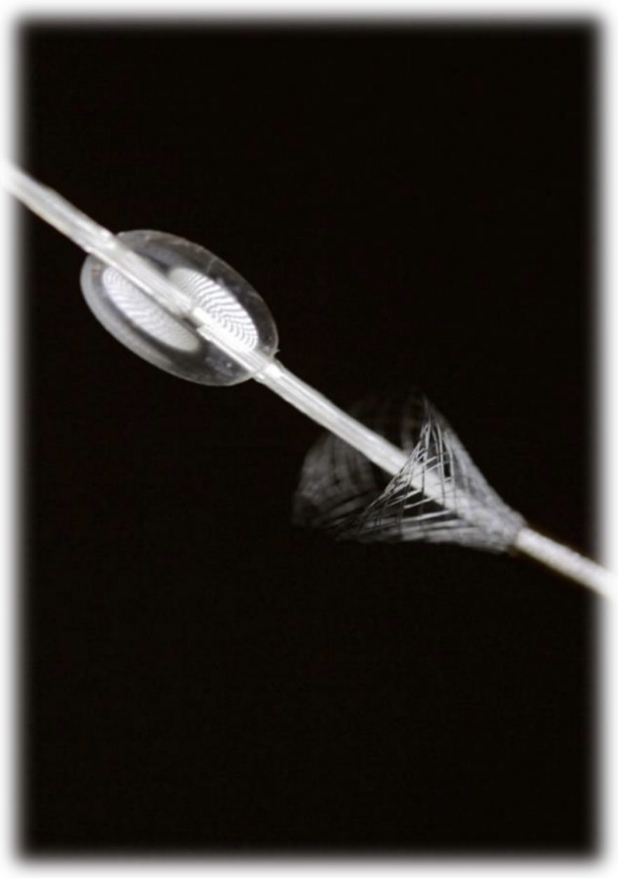 Ichor Vascular’s 14-F Peripheral Reperfusion System Cleared by FDA ...