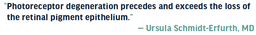 Developing Outcome Targets for Geographic Atrophy Treatment - Retina Today