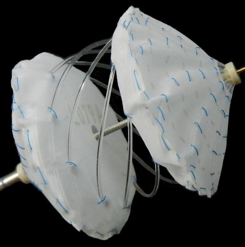 atHeart Medical’s reSept ASD Occluder Evaluated in FIH and Pivotal ...