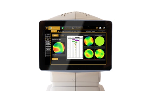 Using MYAH to Analyze Dry Eye Disease - Eyetube