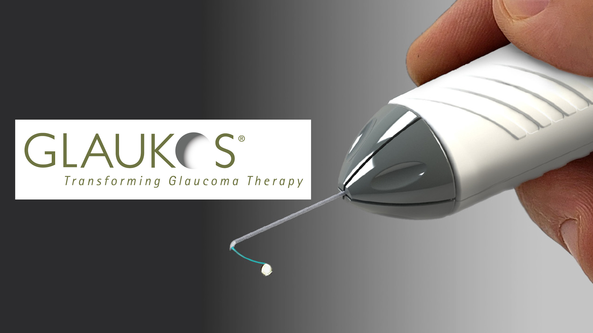 Glaukos Announces Several Advancements to its Pipeline - Eyewire+