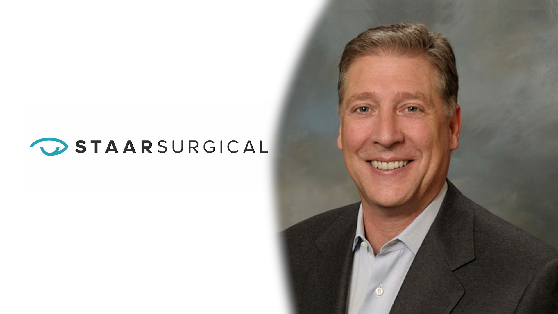 Leadership Change Announced at Staar Surgical - Eyewire+