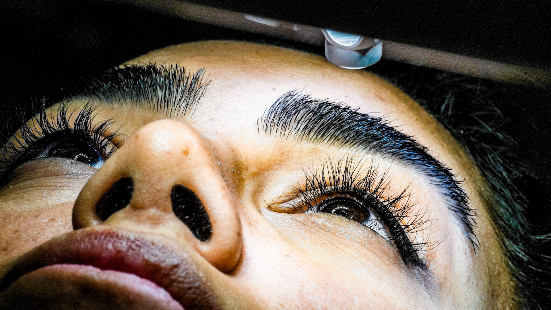 Next Steps and Potential to Treat Other Eye Disease - Eyewire+