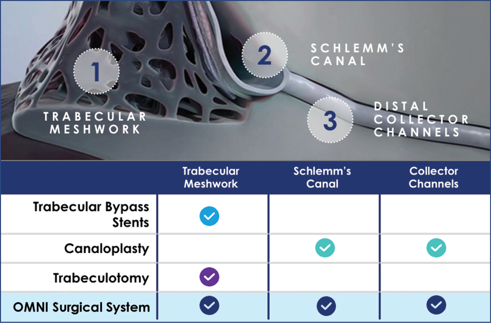 MIGS Beyond Cataract Surgery: An Interventional Mindset - Glaucoma Today